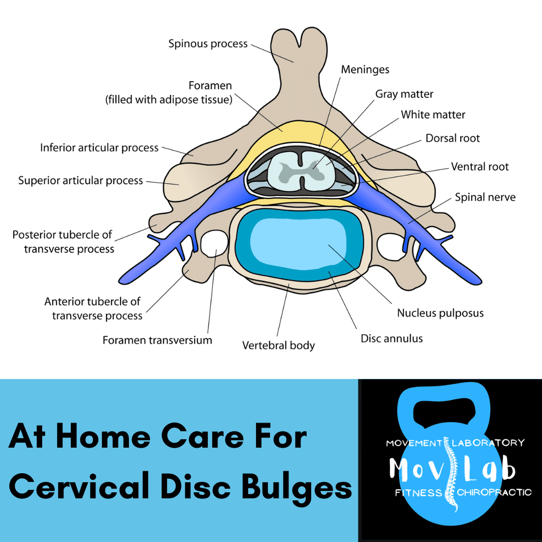 At-Home Care For Cervical (Neck) Disc Bulges | MovLab